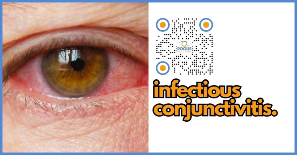 Comprehensive Guide to Infectious Conjunctivitis: Symptoms, Treatment ...
