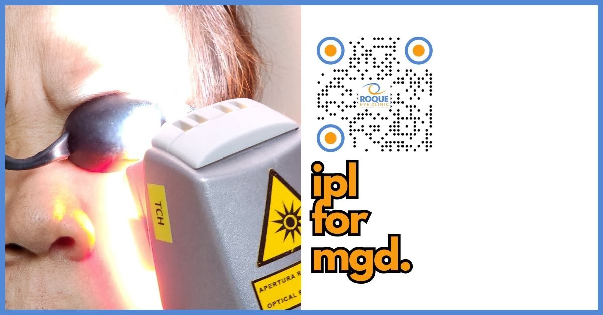 Revolutionizing Dry Eye Treatment: Intense Pulsed Light (IPL) Therapy for Meibomian Gland ...