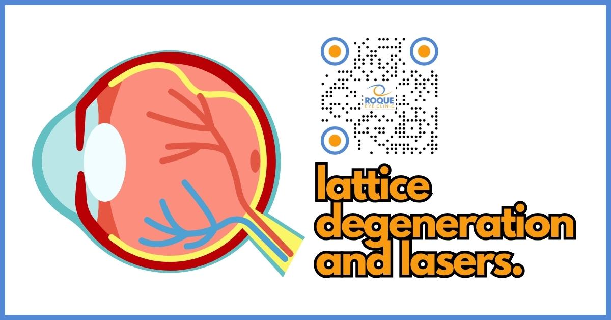 Understanding Lattice Degeneration: Comprehensive Guide on Treatment ...