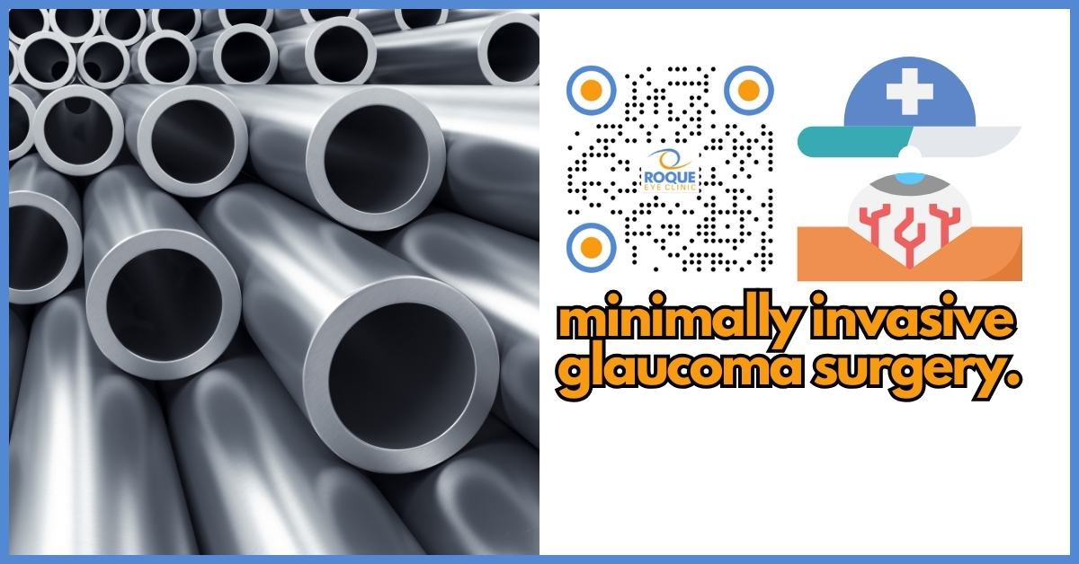 Minimally Invasive Glaucoma Surgery (MIGS): Complete 2025 Patient Guide