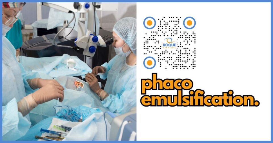 Phacoemulsification: The Modern Approach to Cataract Surgery | Roque ...