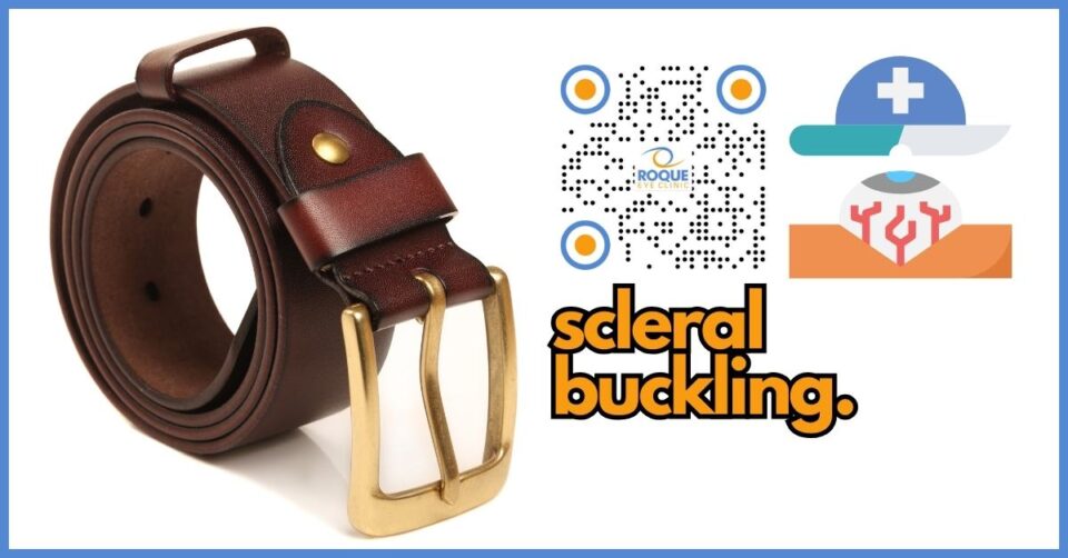 Comprehensive Guide to Scleral Buckling: What You Need to Know - ROQUE ...