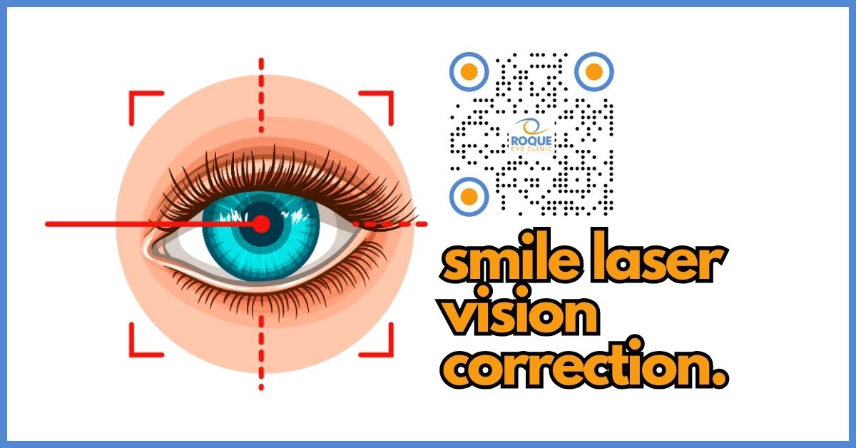 Unveiling the Benefits of SMILE Laser Vision Correction: A Complete Guide