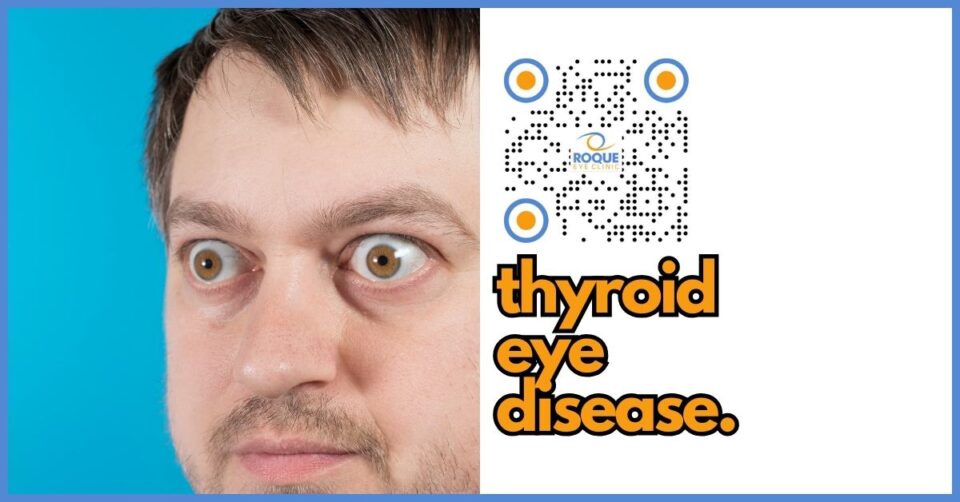 Understanding Thyroid Eye Disease: Symptoms, Treatment, and Management
