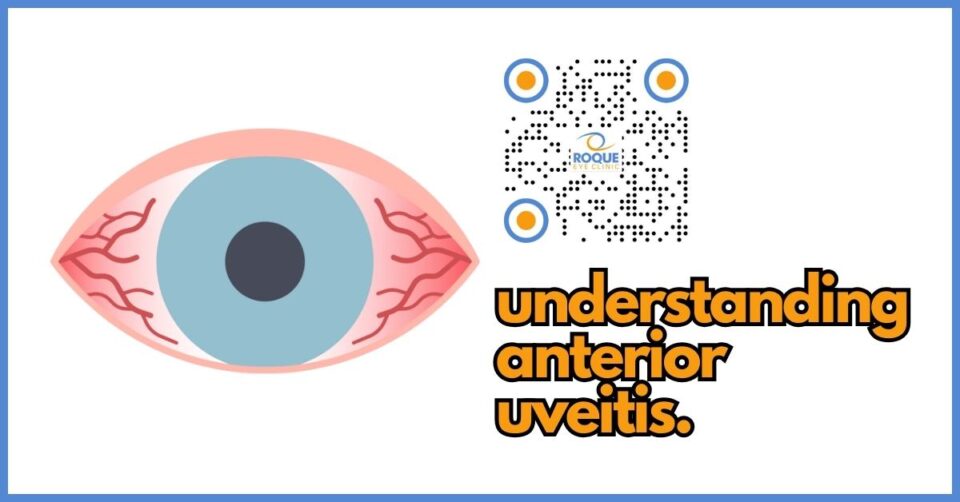 Understanding Anterior Uveitis: Causes, Symptoms, and Treatment Options