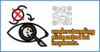 Understanding Dislocated Intraocular Lens Implants: Causes, Symptoms ...
