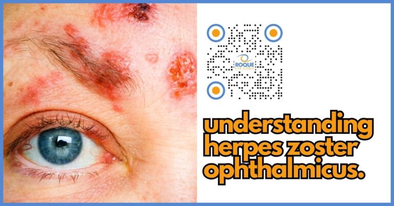 Understanding Herpes Zoster Ophthalmicus: Symptoms, Treatment, and ...