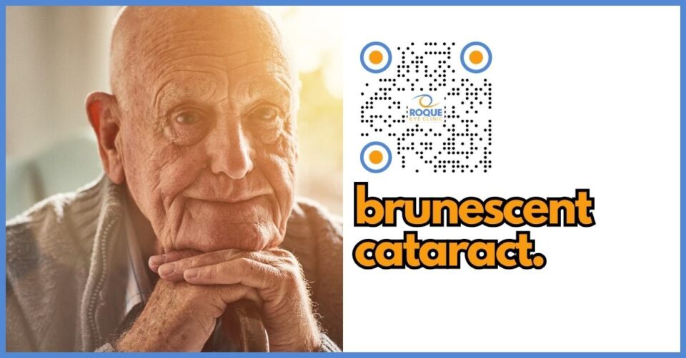 Learn about brunescent cataracts, their causes, symptoms, and treatment ...