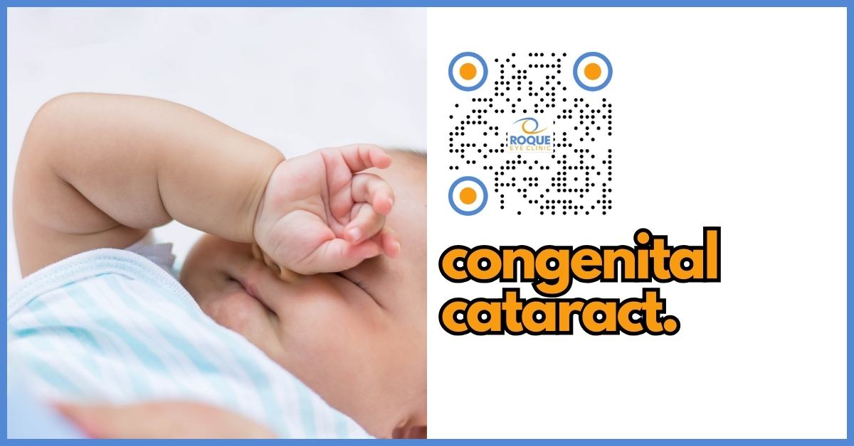 Understanding Congenital Cataracts: A Comprehensive Guide for Patients