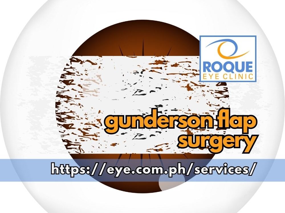 EYE SURGERY | Phacoemulsification | FLACS | Transplantation