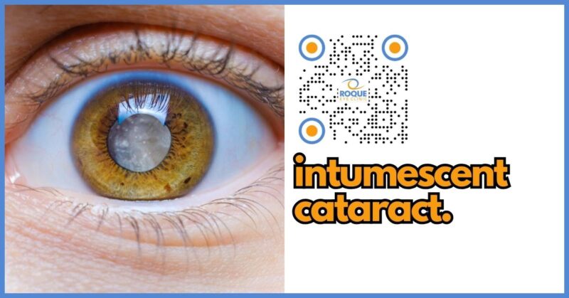 Discover everything you need to know about intumescent cataracts. Learn ...