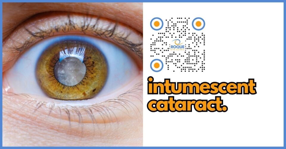 Discover everything you need to know about intumescent cataracts. Learn ...