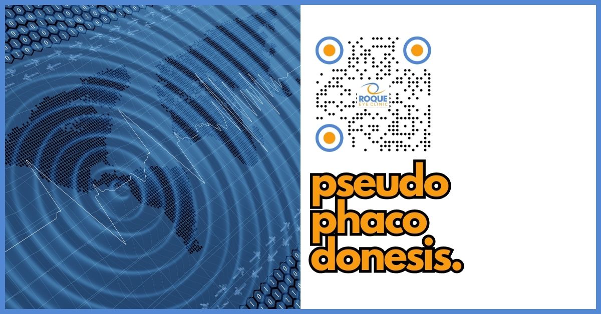 Pseudophacodonesis: Comprehensive Guide for Patients