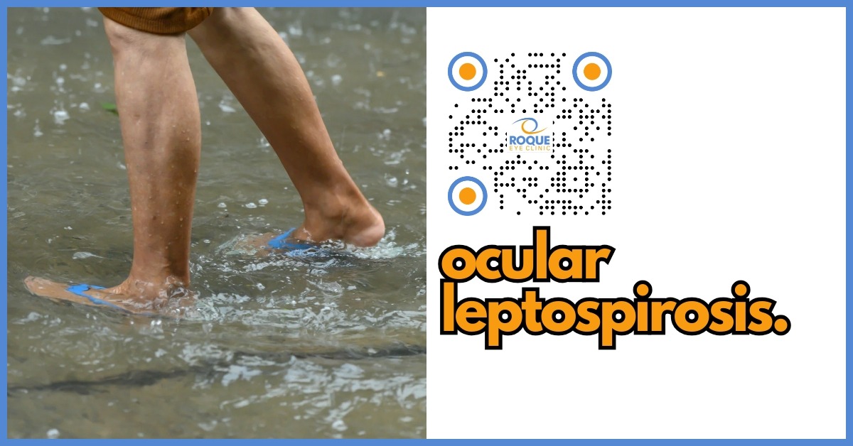 Understanding Ocular Leptospirosis: Symptoms, Diagnosis, and Treatment ...