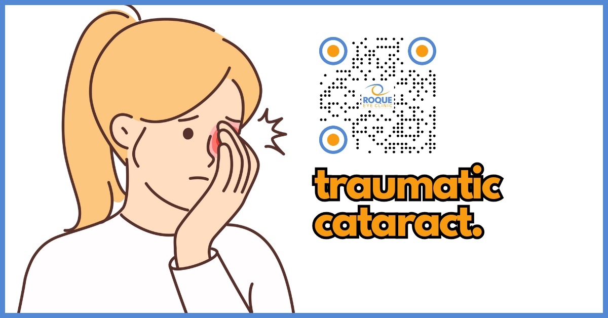 Traumatic Cataracts: A Comprehensive Guide for Patients - ROQUE Eye ...