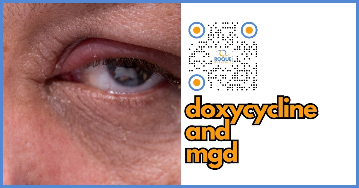 Eyelid Glands Meibomian Gland Dysfunction | GPonline