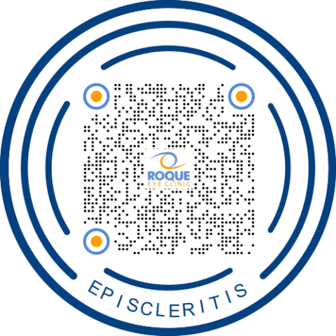 Understanding Benign Eyelid Warts: A Comprehensive Guide - ROQUE Eye ...